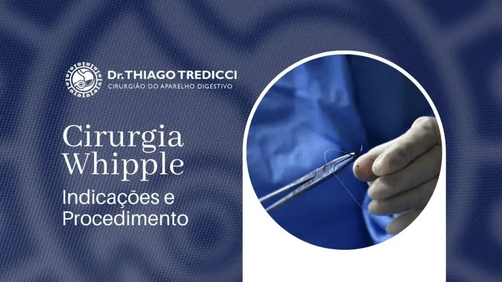 Cirurgia Whipple: Indicações e Procedimento - Blog Dr. Thiago Tredicci