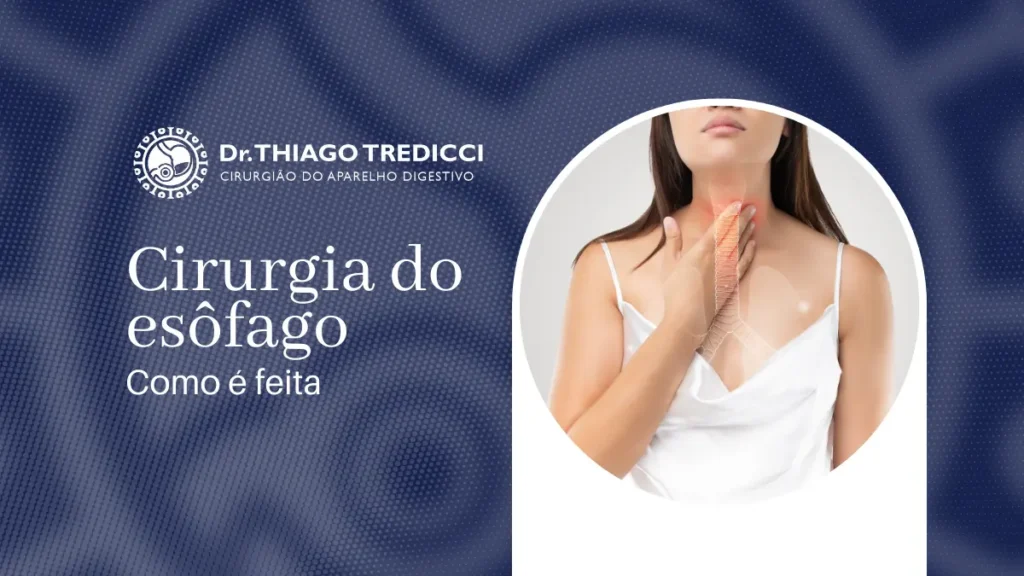 Como é feita a cirurgia do esôfago? Entenda o procedimento - Blog Dr ...