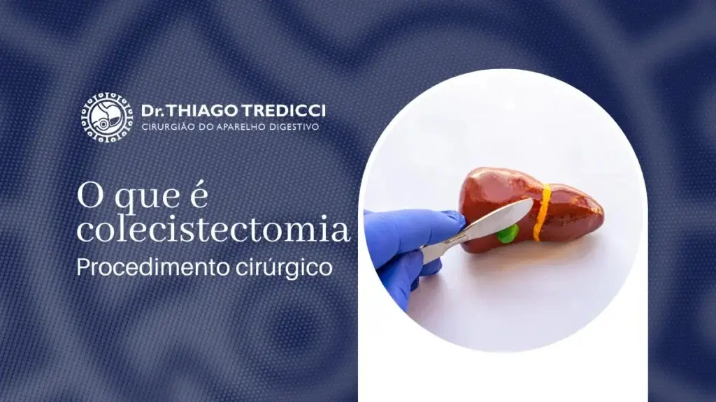 O que é Colecistectomia? Entenda Quando Ela é Indicada - Blog Dr ...